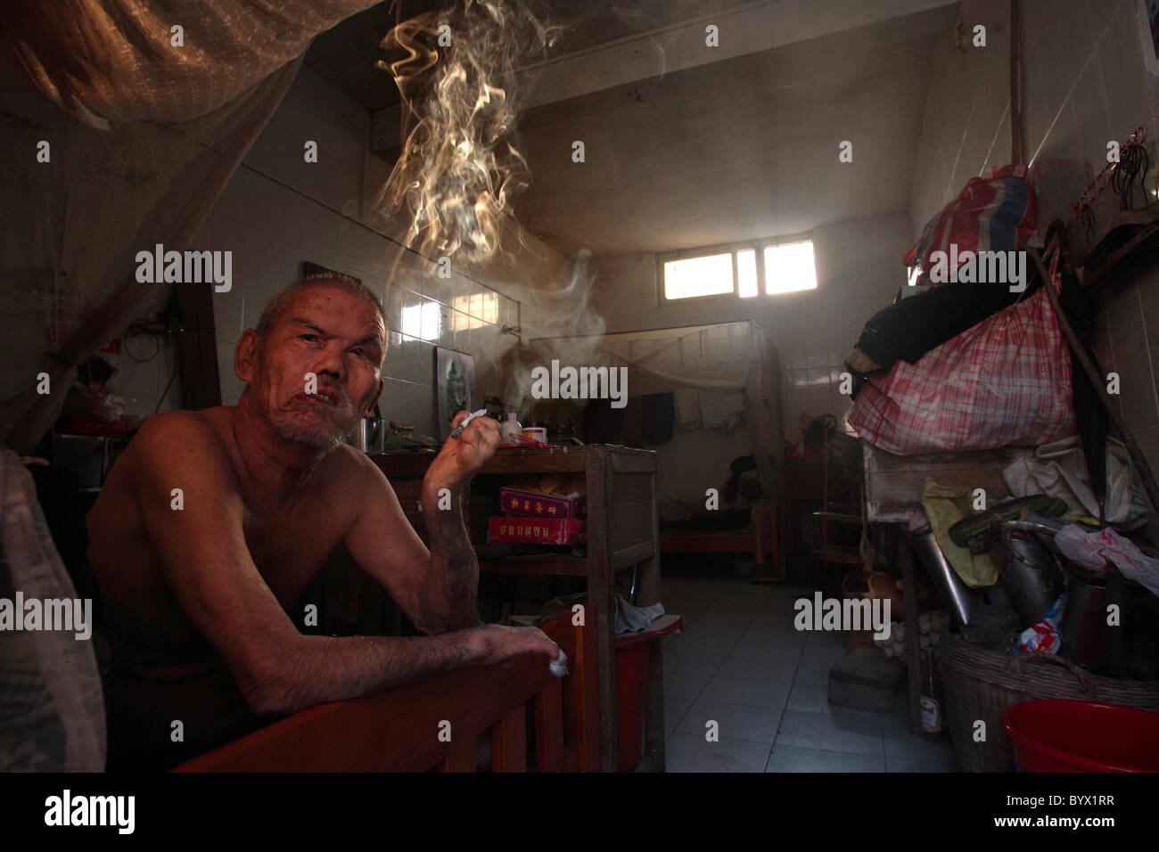 * COLONY OF LEPERS A community of leprosy victims live in a rural ...