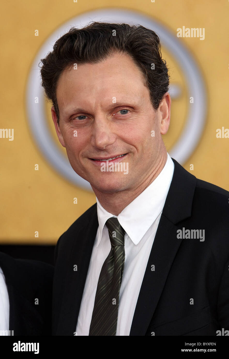Tony Goldwyn No Eyebrows
