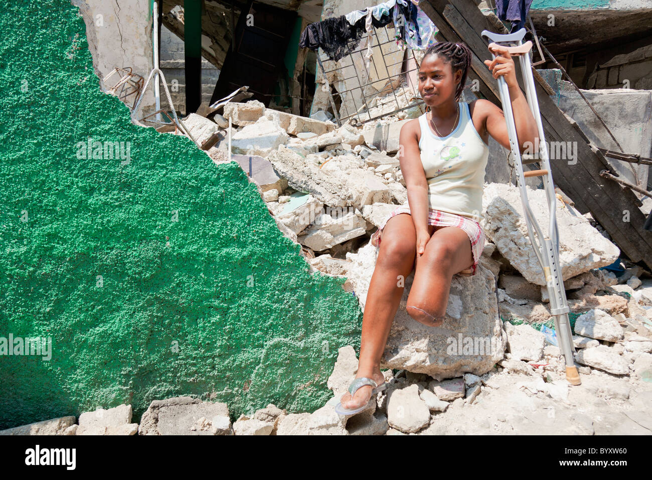 Woman lost leg hi-res stock photography and images - Alamy