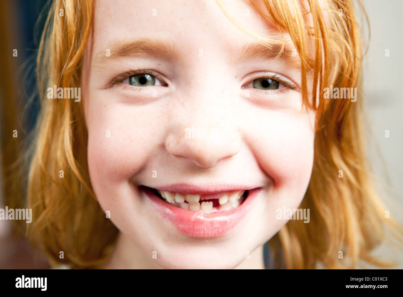 Portrait of a girl with red hair with a missing tooth Stock Photo - Alamy