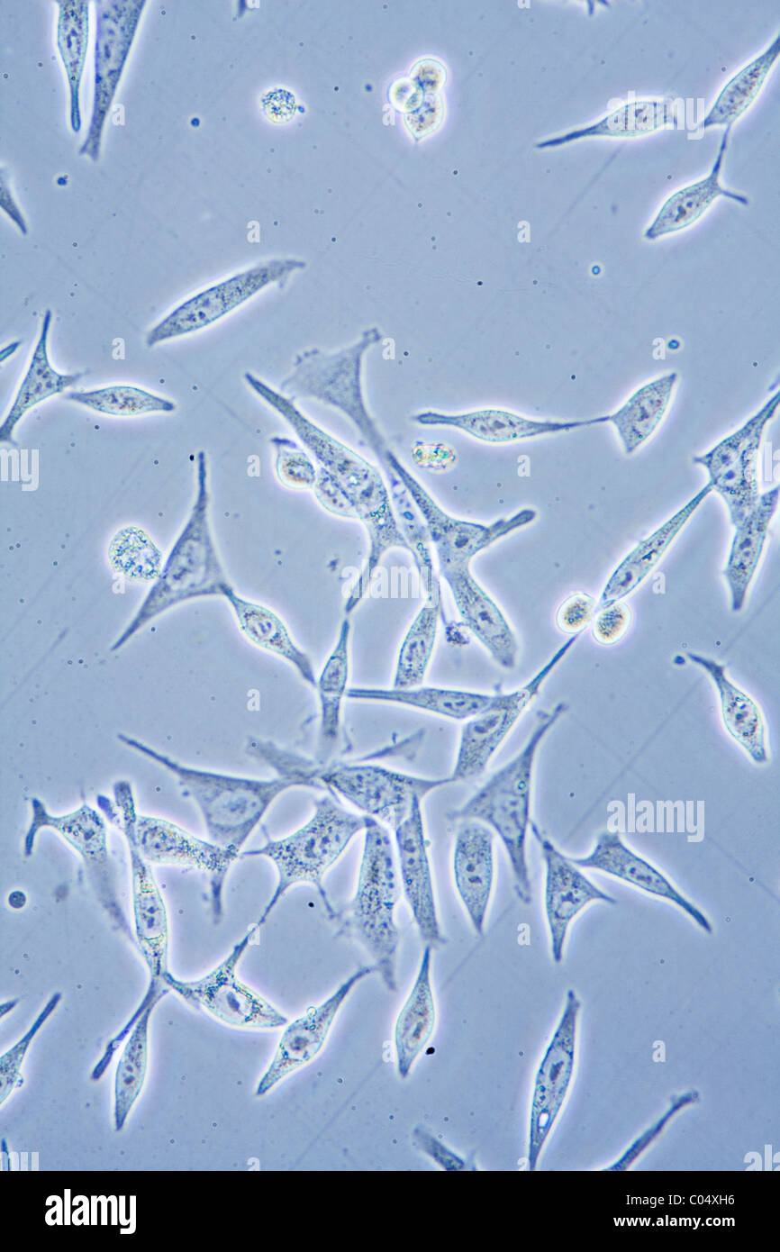 Prostate cancer cells High Resolution Stock Photography and Images - Alamy