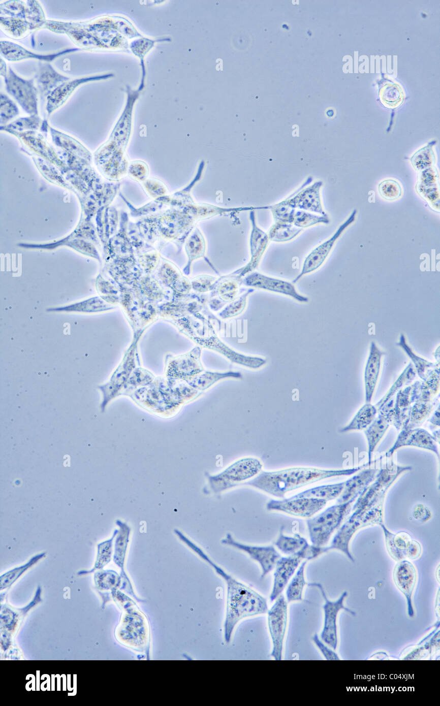 Prostate cancer cells High Resolution Stock Photography and Images - Alamy