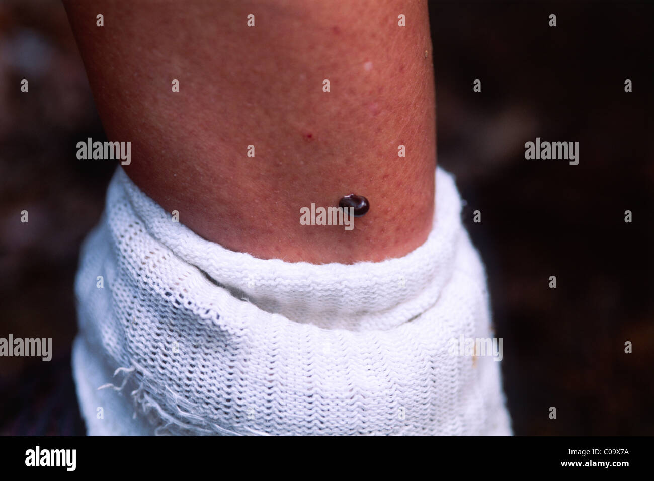 Leech hi-res stock photography and images - Alamy