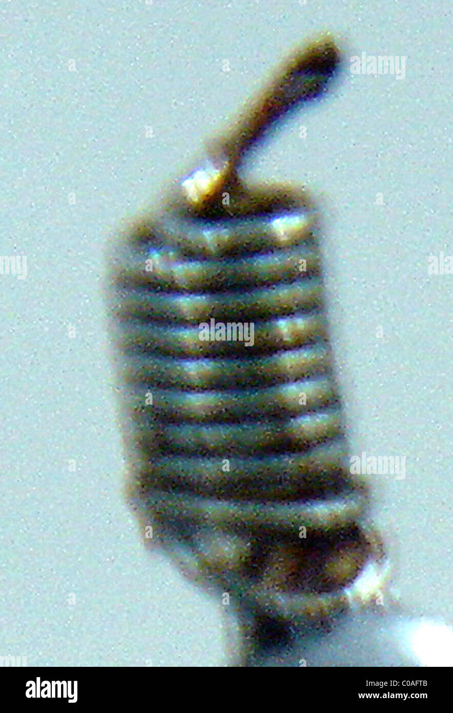 SPRINGS FOUND IN 'SORE BACK' WOMAN A woman has had five rusty springs ...