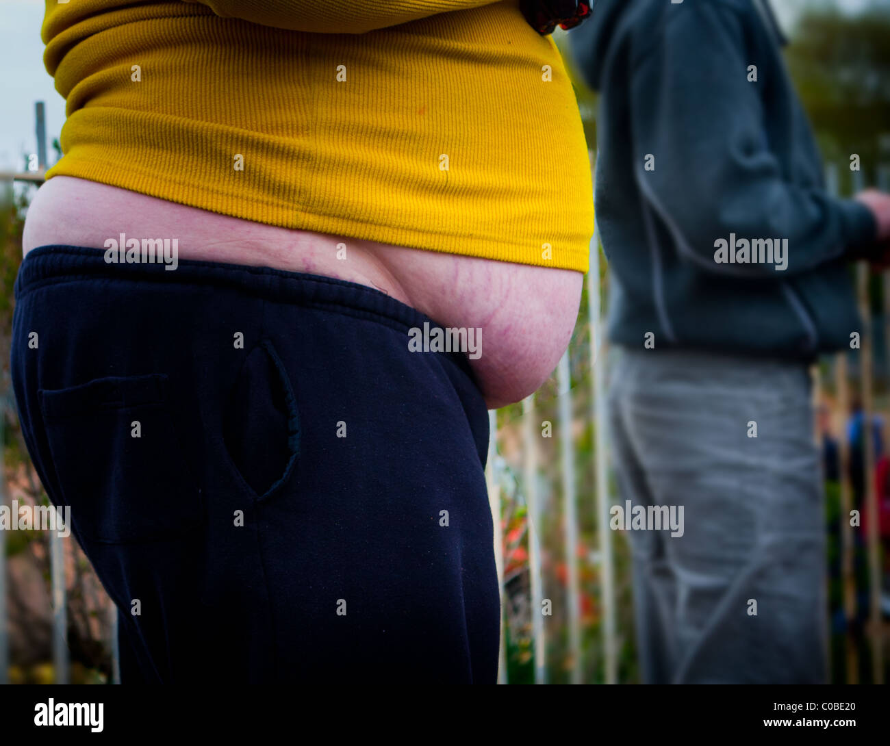 Obesity hi-res stock photography and images - Alamy