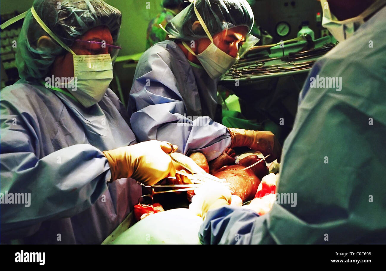 Operating theater room. A baby on his way during a C Section surgery ...