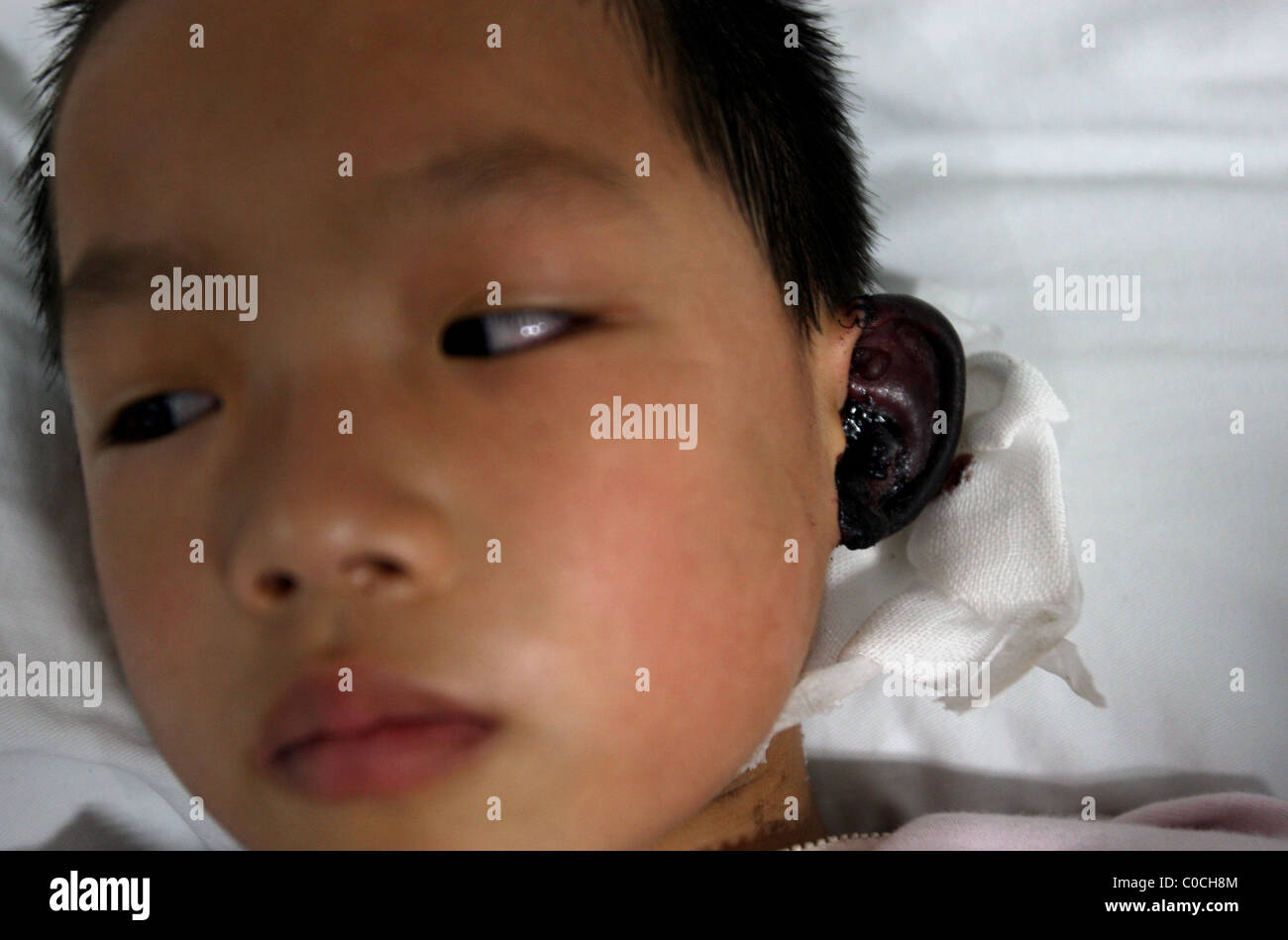 Missing an ear hi-res stock photography and images - Alamy