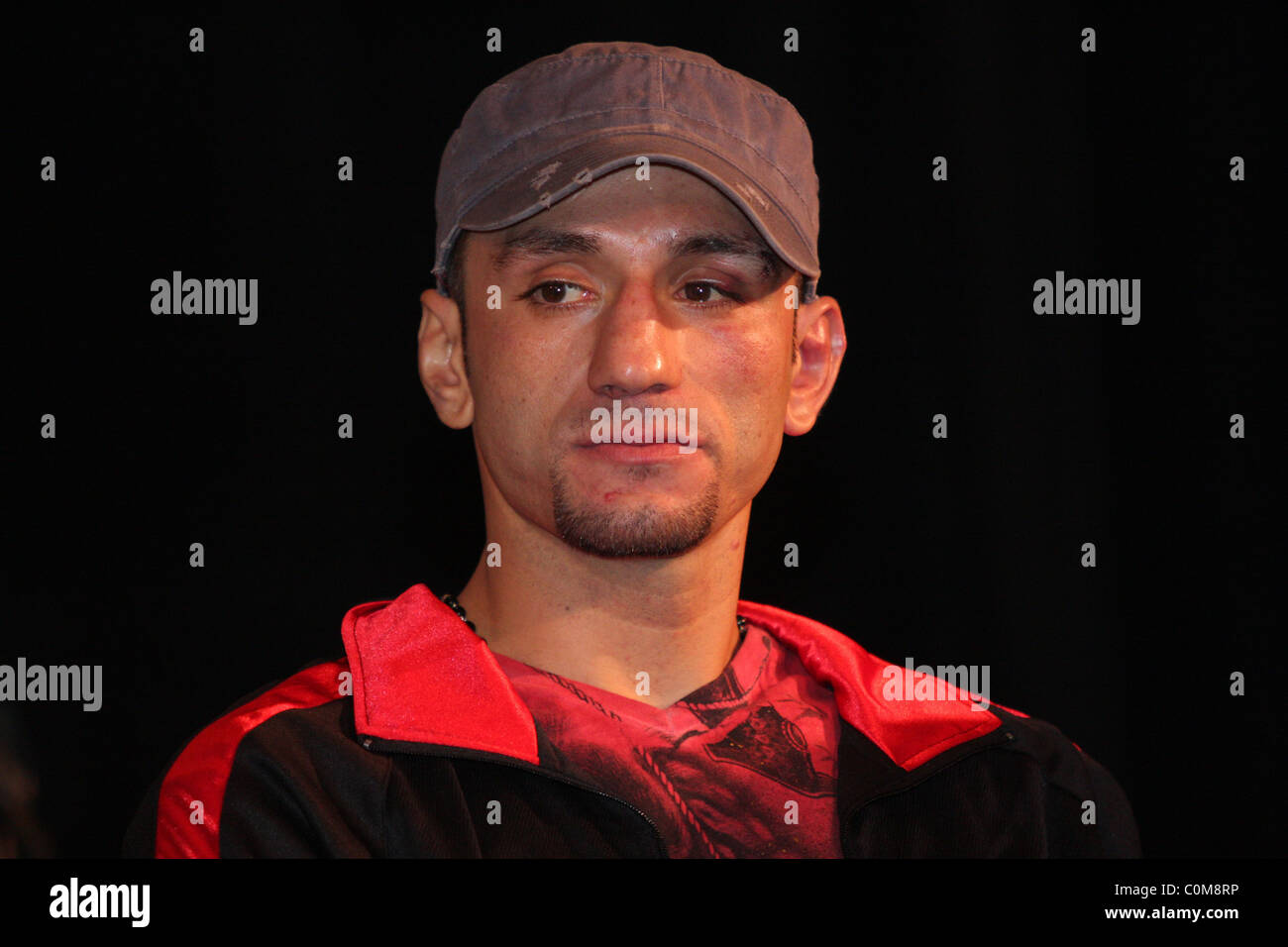Sergio Mora attends the post fight press conference after being beaten ...