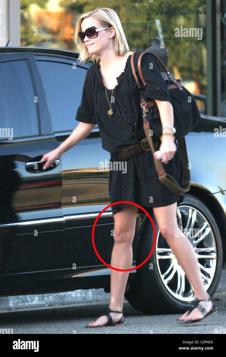 Grazed Back High Resolution Stock Photography and Images - Alamy