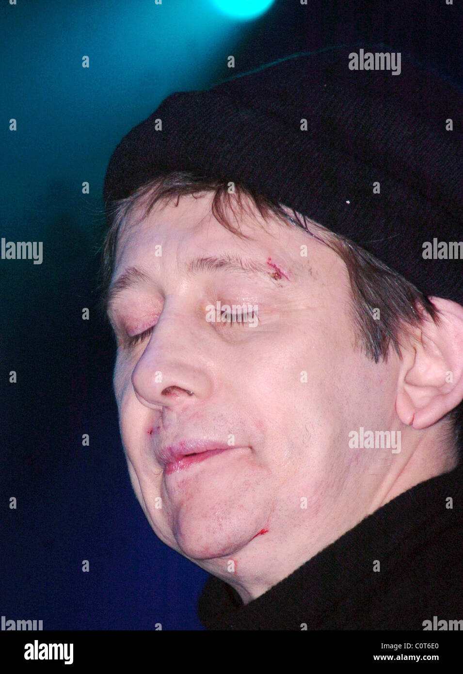 The Pogues singer Shane MacGowan performing live at the King's Hall ...