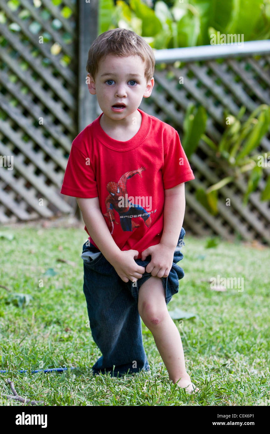 Graze child hi-res stock photography and images - Alamy