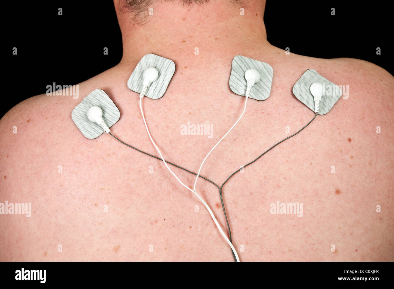 photo male with acute neck pain, electrodes to tens unit Stock Photo ...