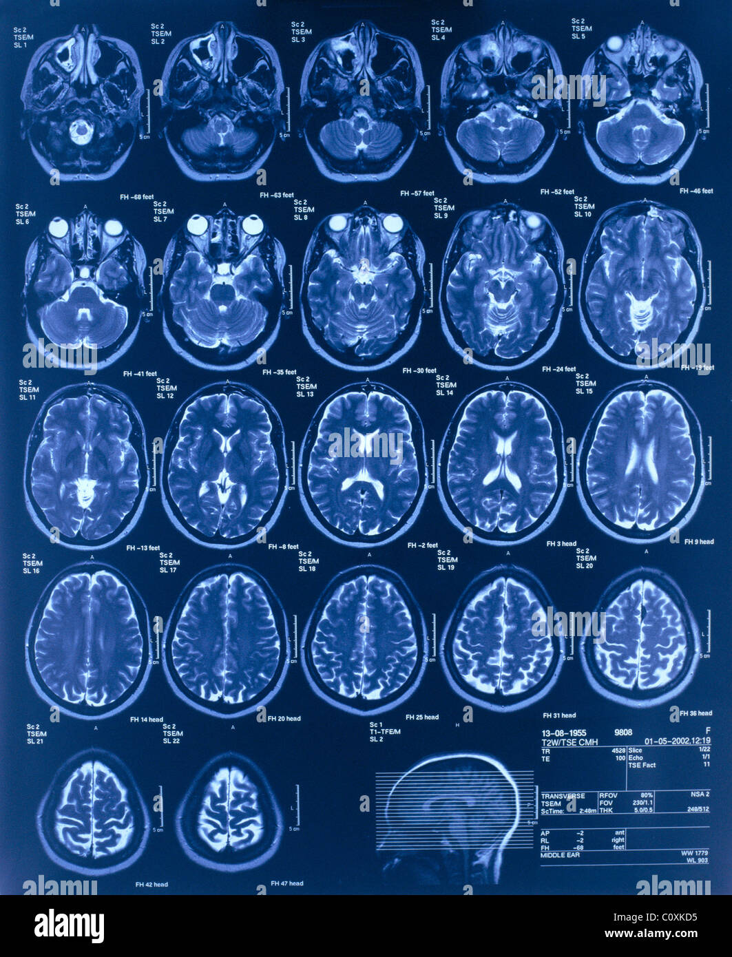 Brain scan activity hi-res stock photography and images - Alamy