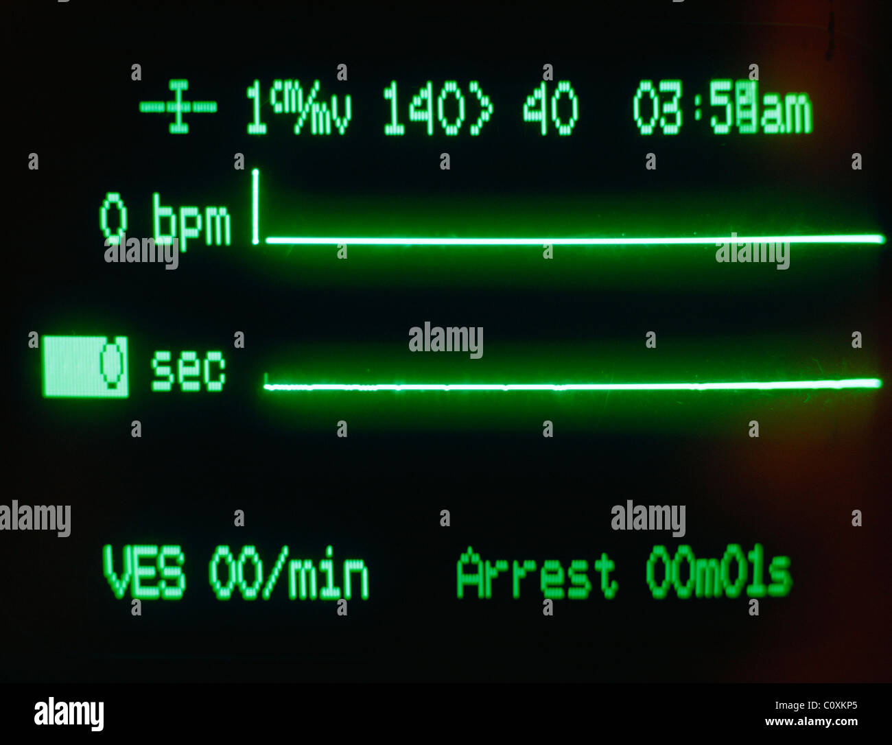 Nhs heart monitor hi-res stock photography and images - Alamy