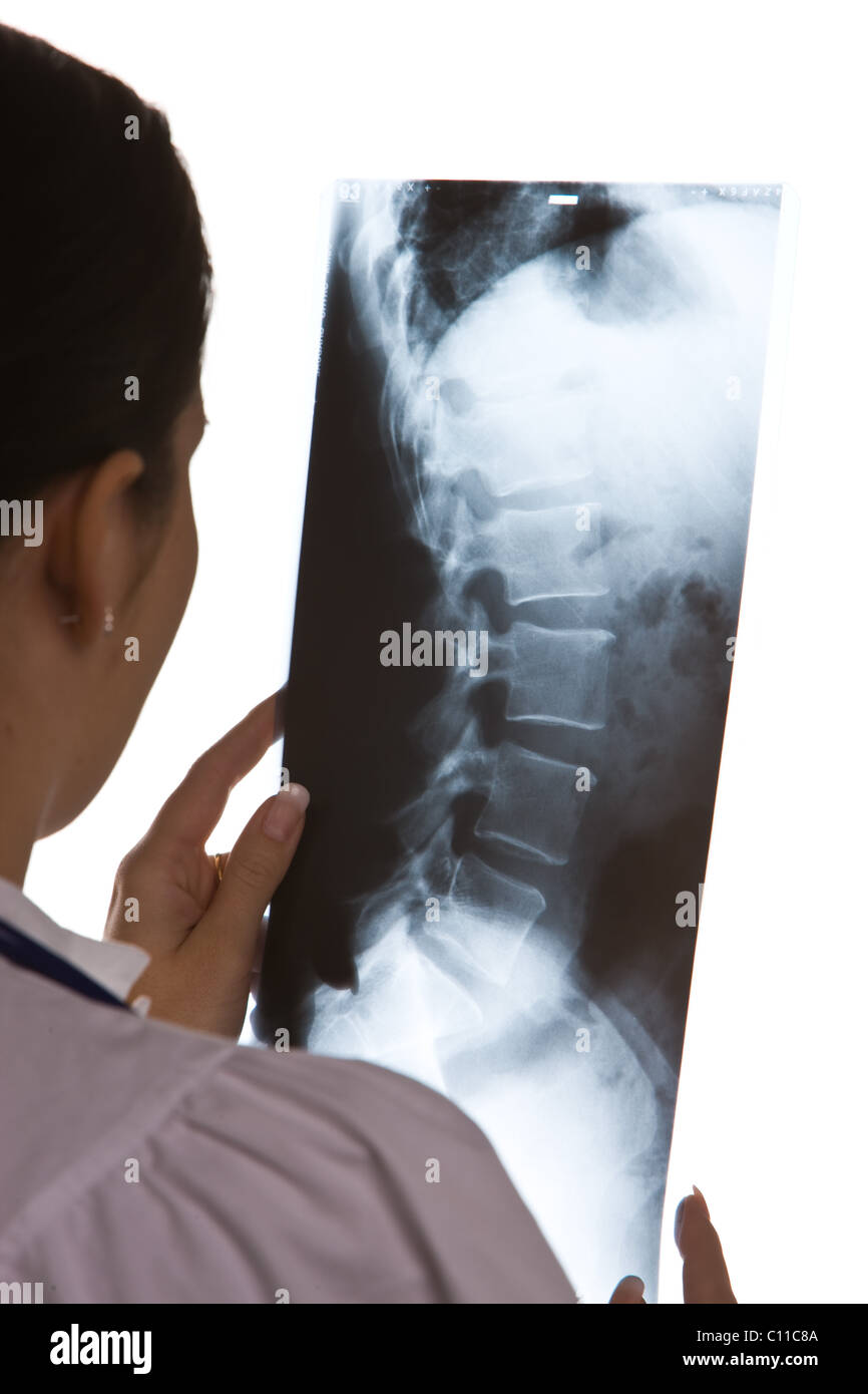 Doctor with x-ray Stock Photo - Alamy