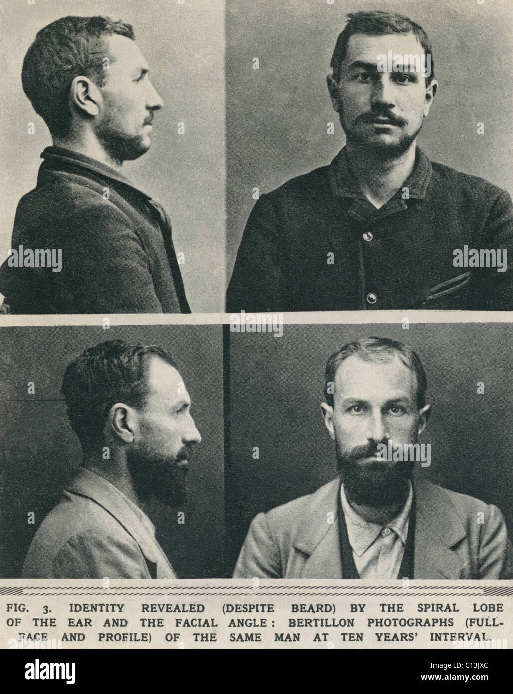 Bertillon system photographs taken at a ten year's interval, reveal it ...