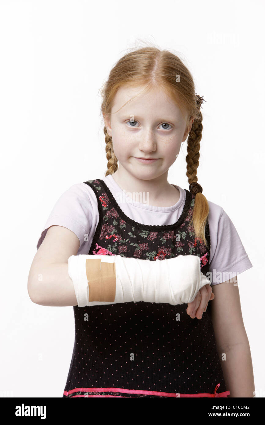 Long arm cast hi-res stock photography and images - Alamy