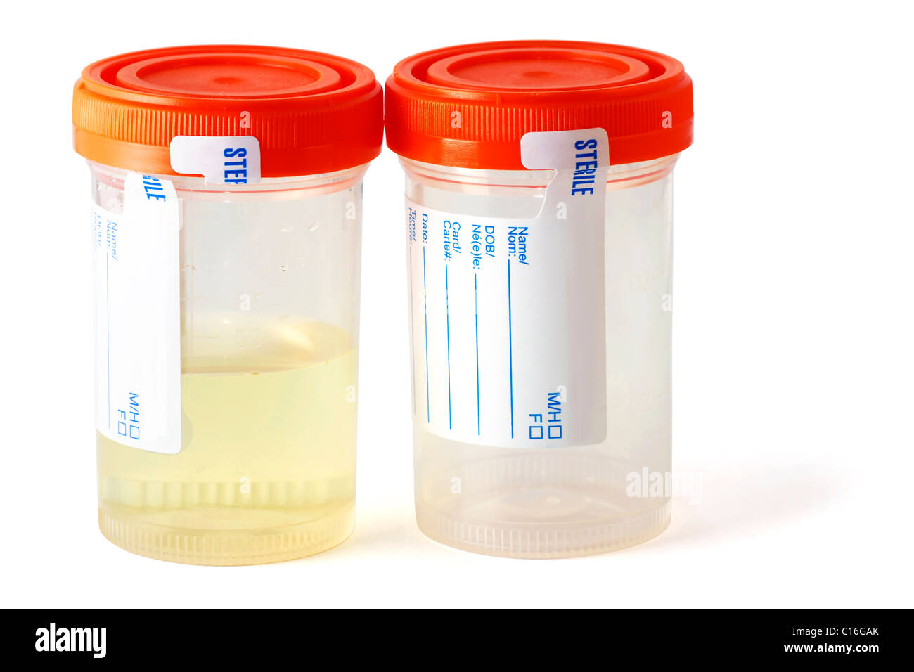 One empty an sterile specimen collection bottle, the other bottle is ...