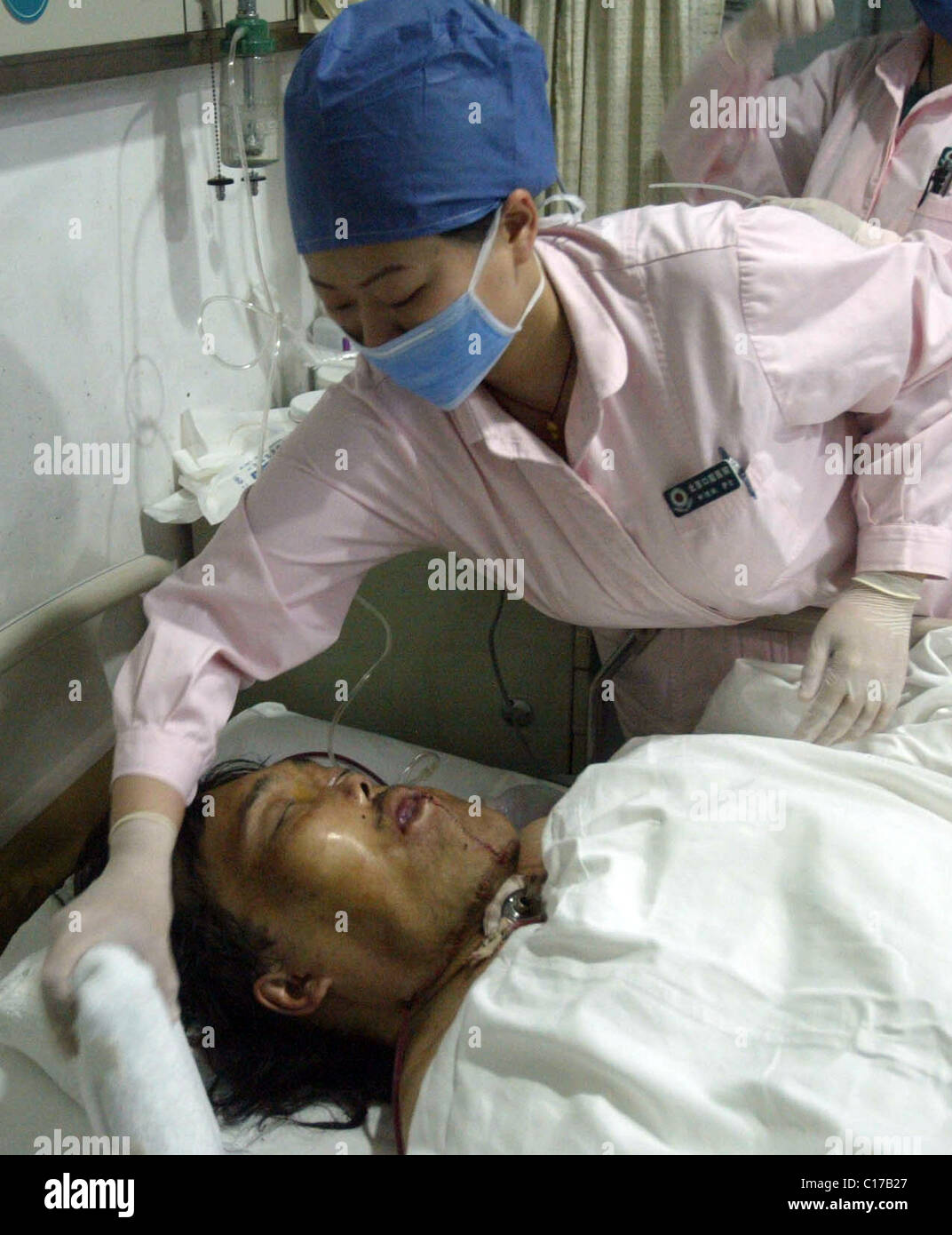 Hippo man saved by surgery Doctors at Beijing stomatological hospital ...