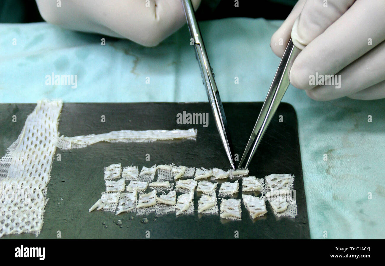 A Chinese burn victim has become the country's first successful trans ...