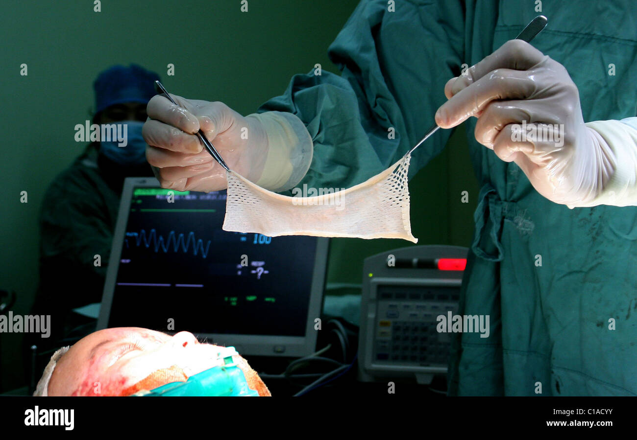 A Chinese burn victim has become the country's first successful trans ...