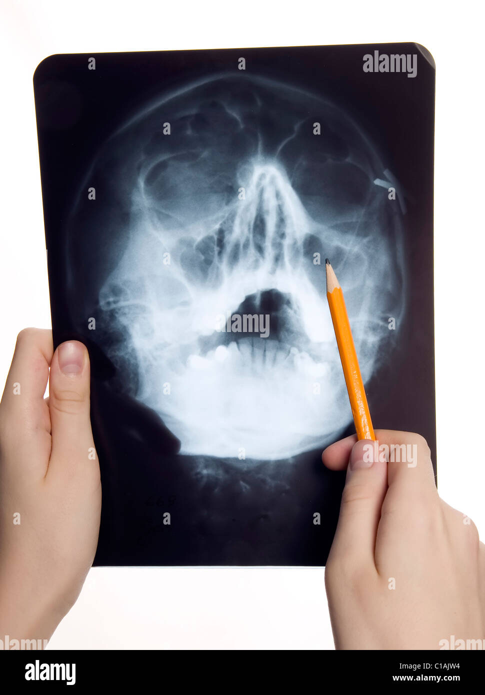 Roentgen hi-res stock photography and images - Alamy