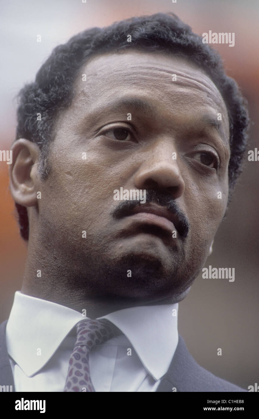 Jesse Jackson Cleft Lip