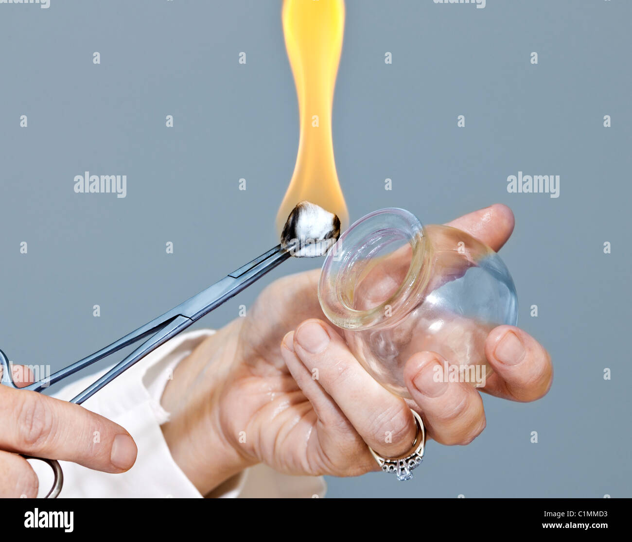 Cupping therapy hi-res stock photography and images - Alamy