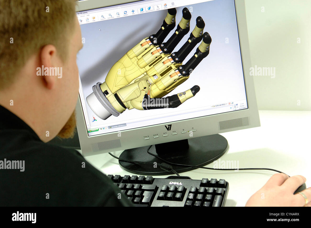 Bionic Hand The world's most advanced, commercially available, bionic ...