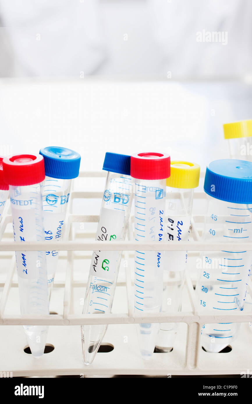 Hospital lab test labels hi-res stock photography and images - Alamy