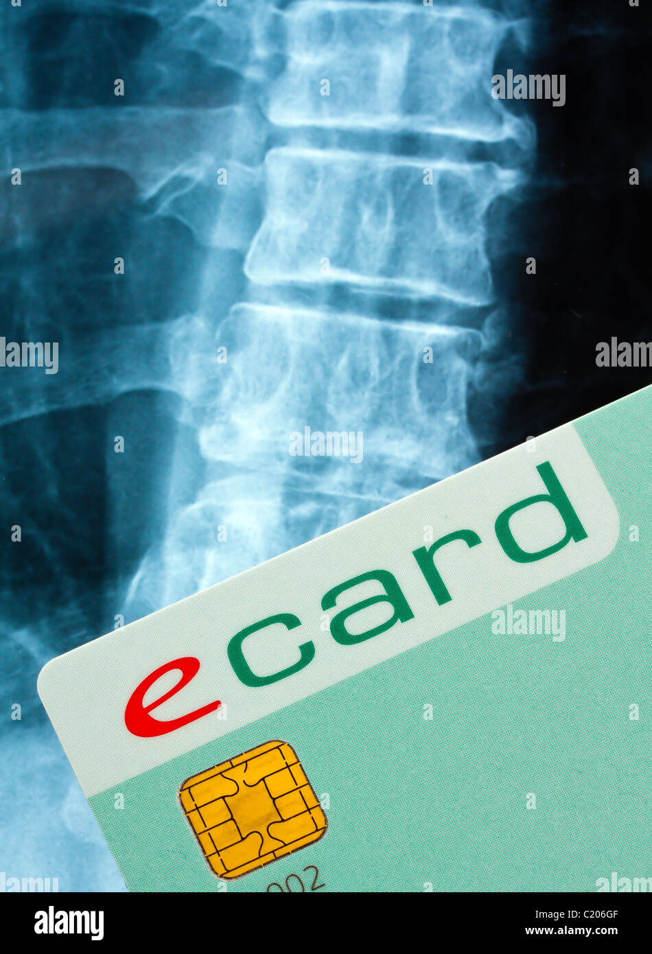 E-Card to settle the medical bills of the Austrian health insurance ...
