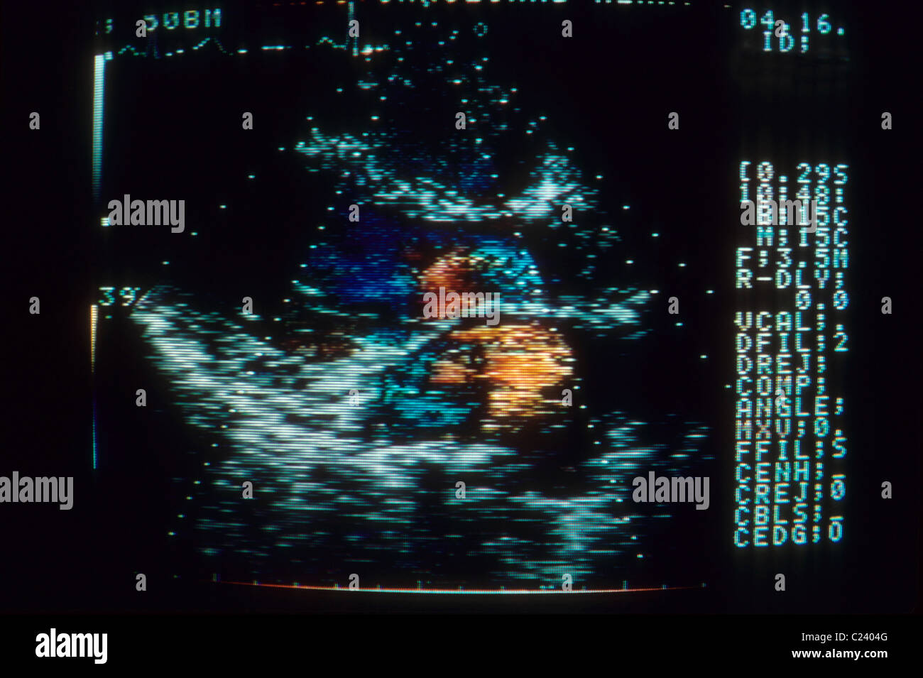 Sonograms hi-res stock photography and images - Alamy