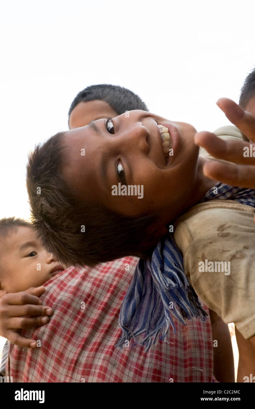 Rotten Teeth Child High Resolution Stock Photography and Images - Alamy