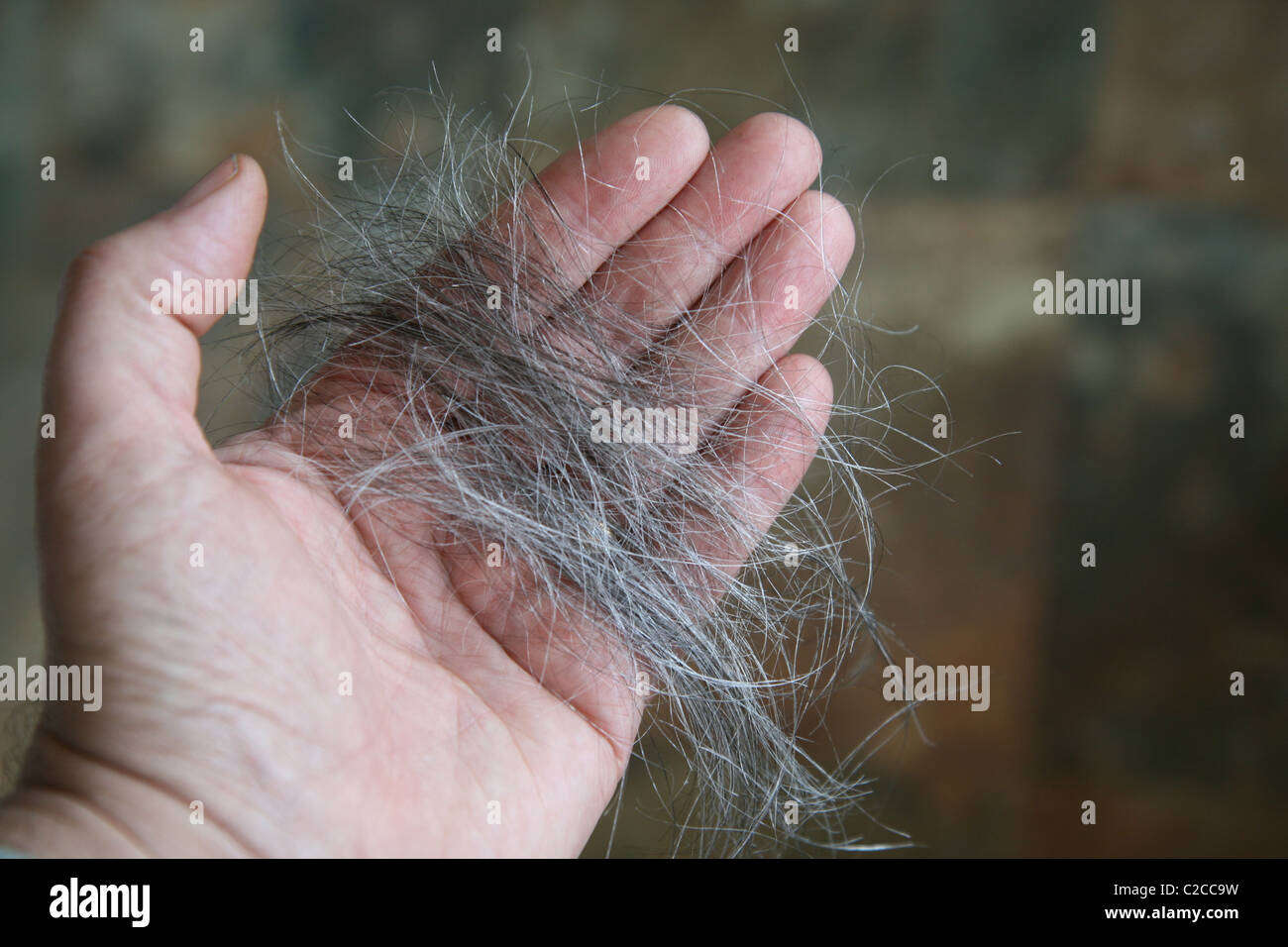Hair loss hi-res stock photography and images - Alamy