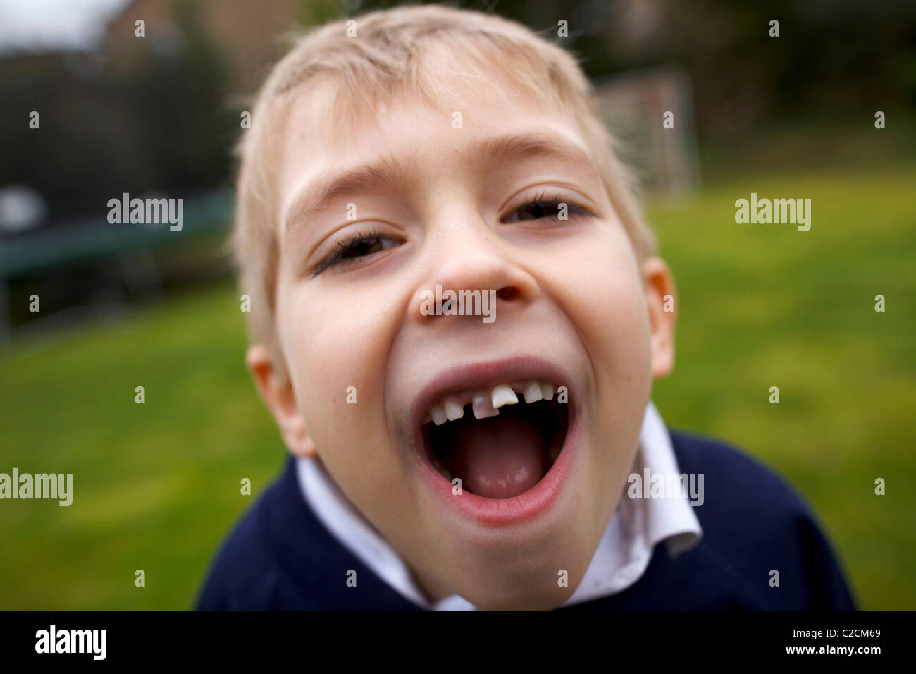 Six year old boy with wobbly front teeth Stock Photo - Alamy