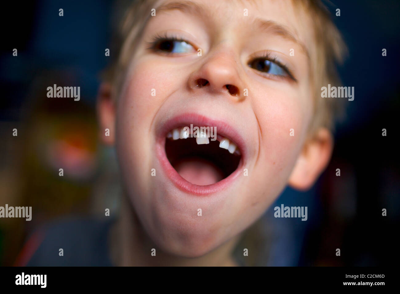 Six year old boy with wobbly front teeth Stock Photo - Alamy