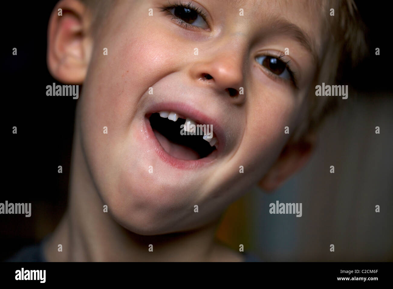 Six year old boy with wobbly front teeth Stock Photo - Alamy