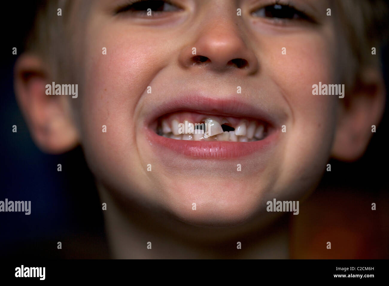 Six year old boy with wobbly front teeth Stock Photo - Alamy