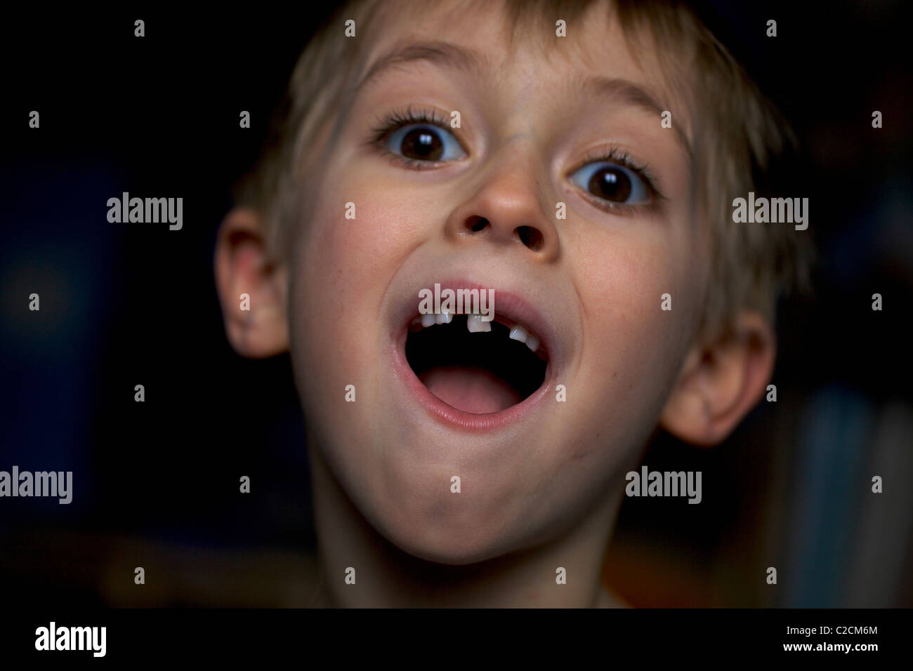 Six year old boy with wobbly front teeth Stock Photo - Alamy