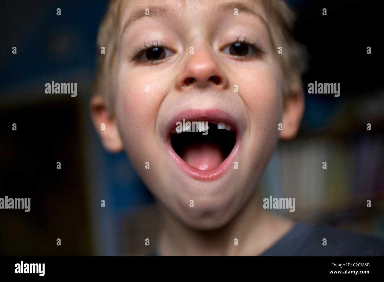 Six year old boy with wobbly front teeth Stock Photo - Alamy