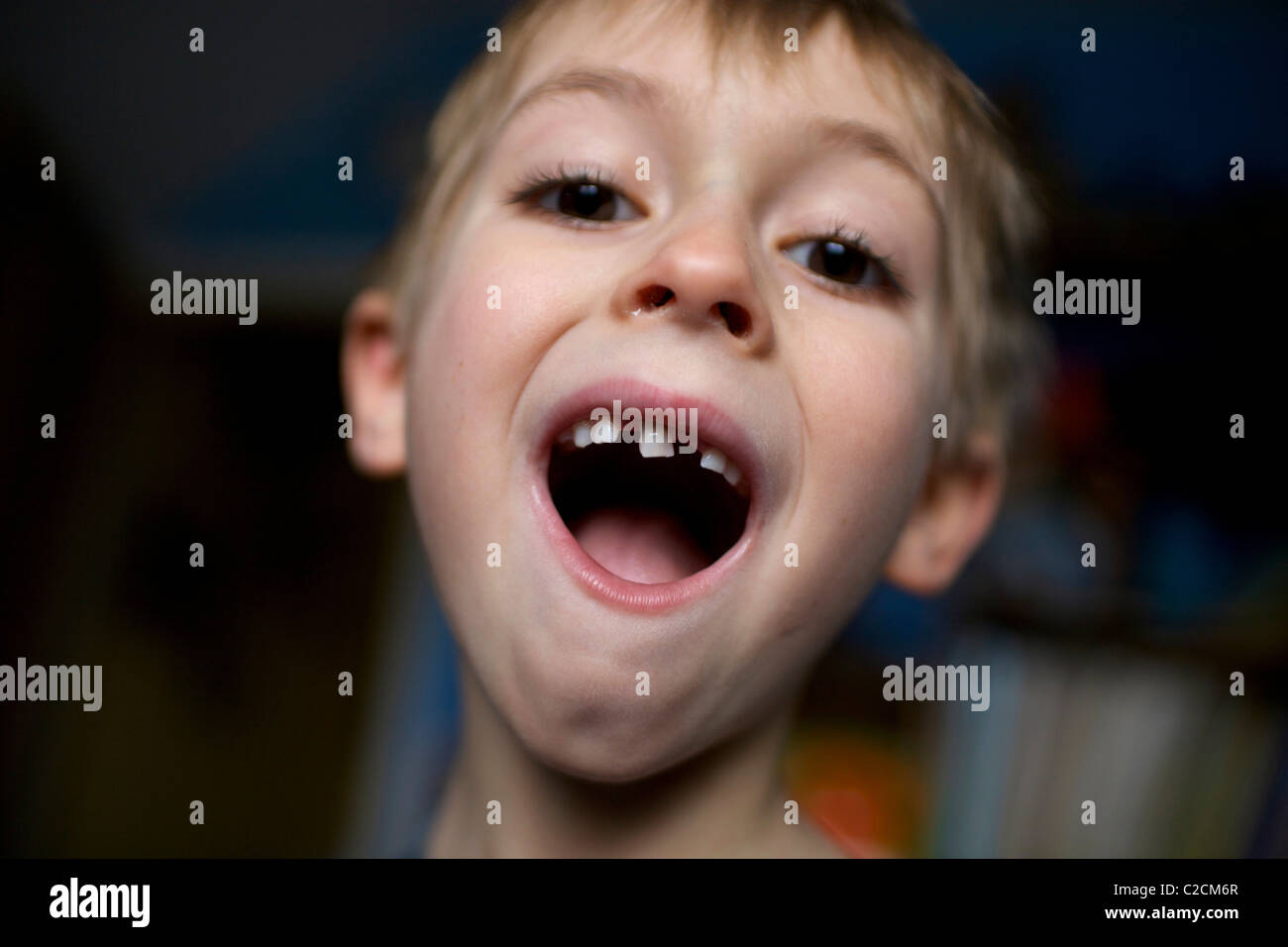 Wobbly teeth hi-res stock photography and images - Alamy