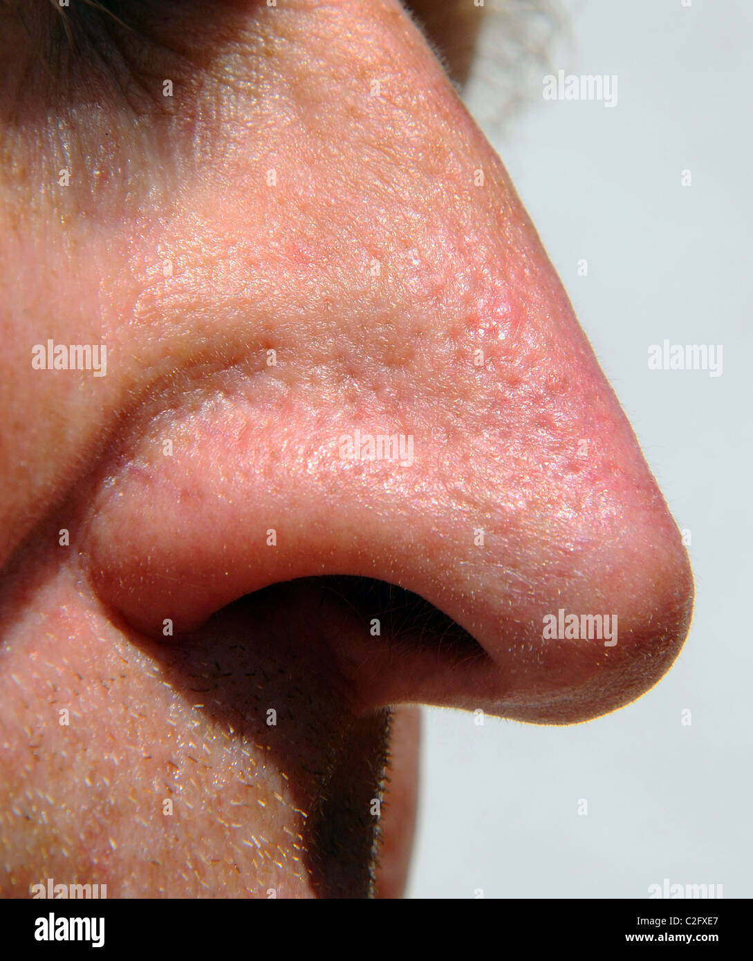 Nostrils human nose hi-res stock photography and images - Alamy