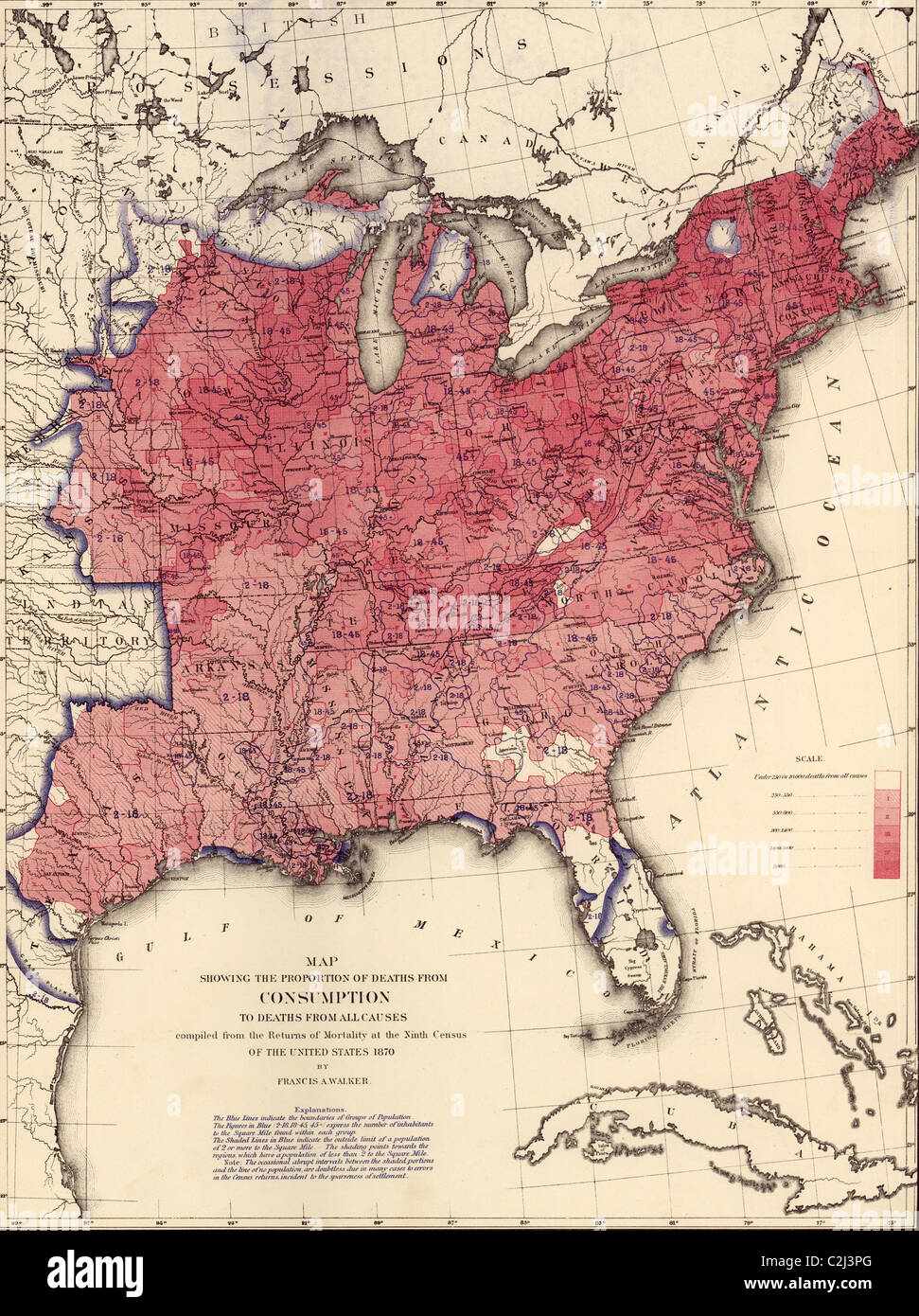 Occurrence of Tuberculosis or Consumption - 1870 Stock Photo - Alamy