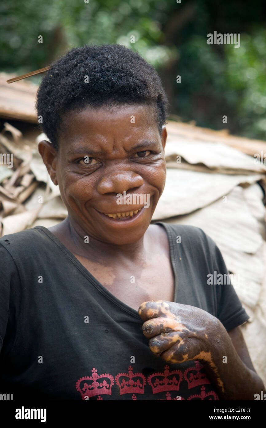Pygmy People Teeth Meet The Extreme Pygmy Tribe Who File Their Teeth