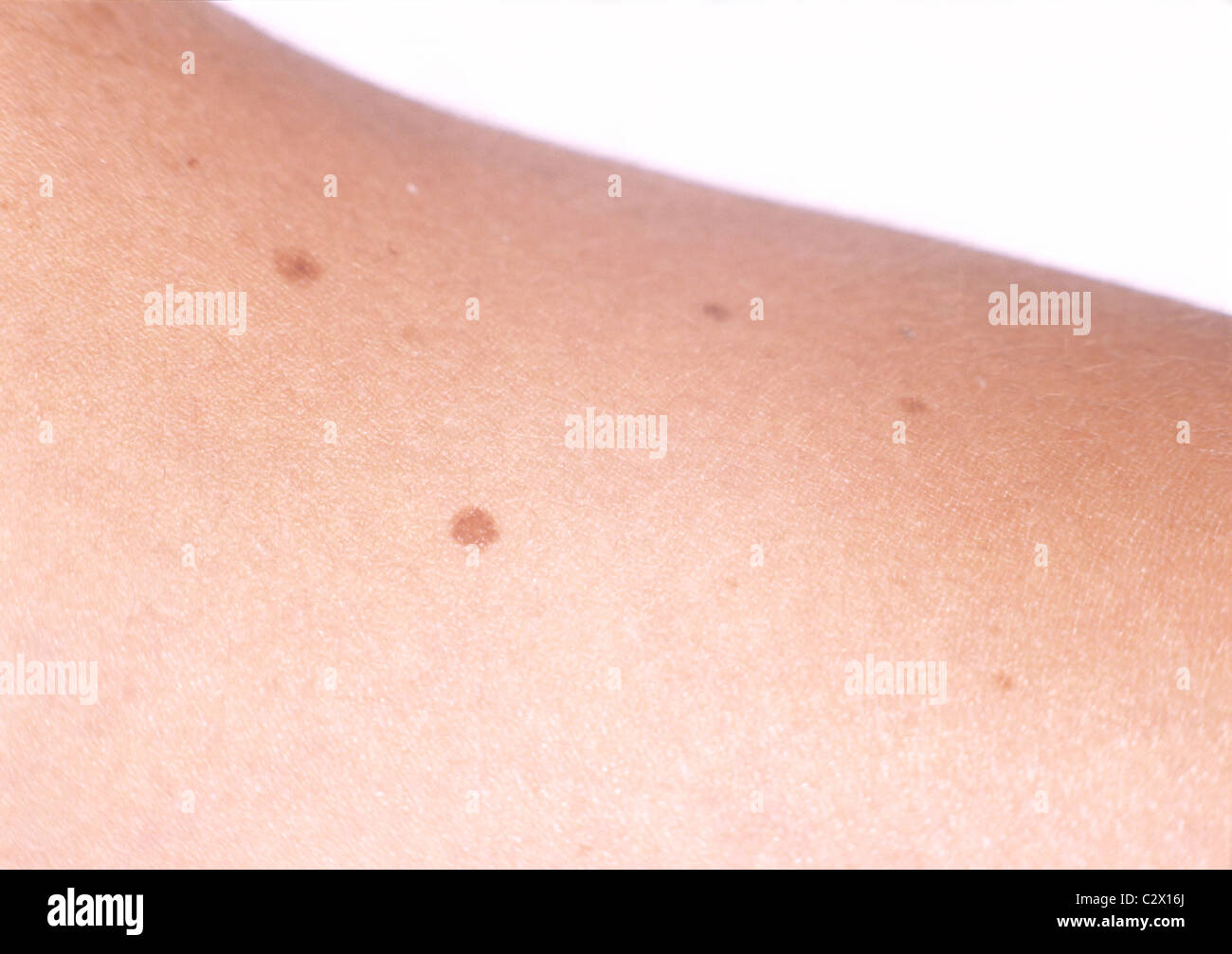 close up female body parts arm Stock Photo - Alamy