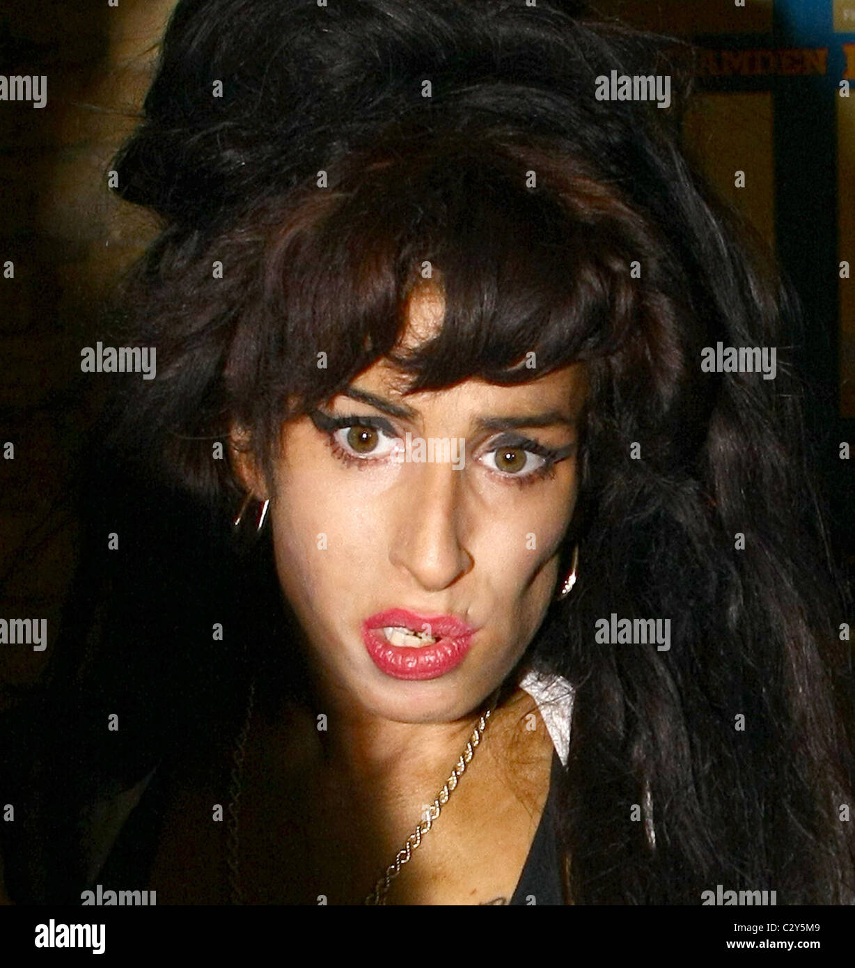 Amy Winehouse looking very tired and showing a cut on her right arm ...
