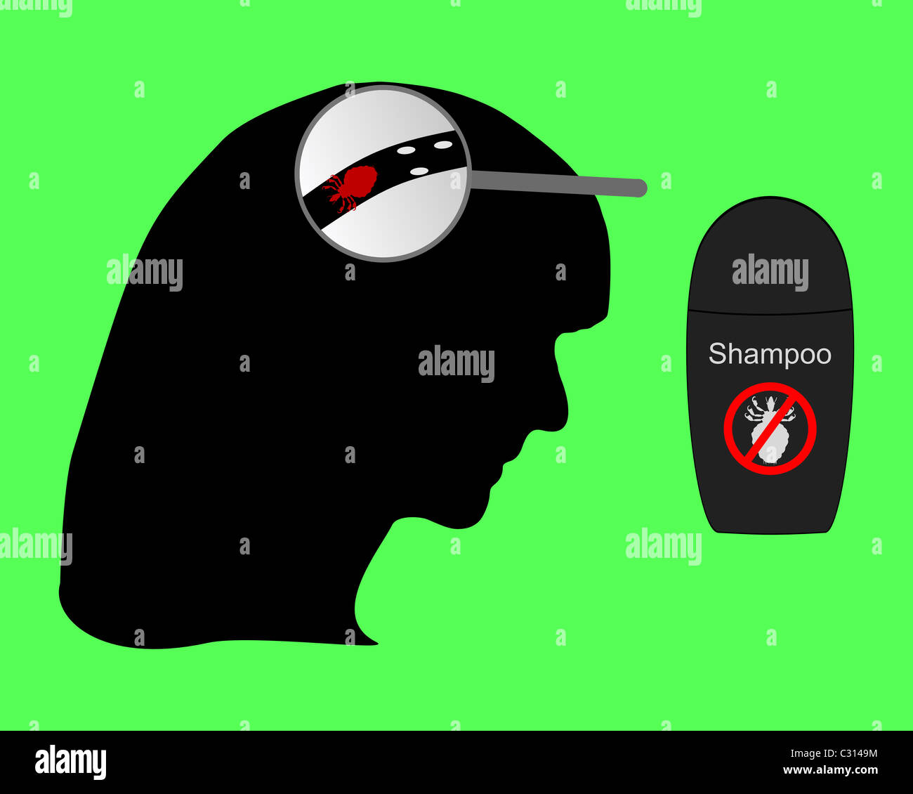 Head lice pediculus humanus capitis hi-res stock photography and images ...