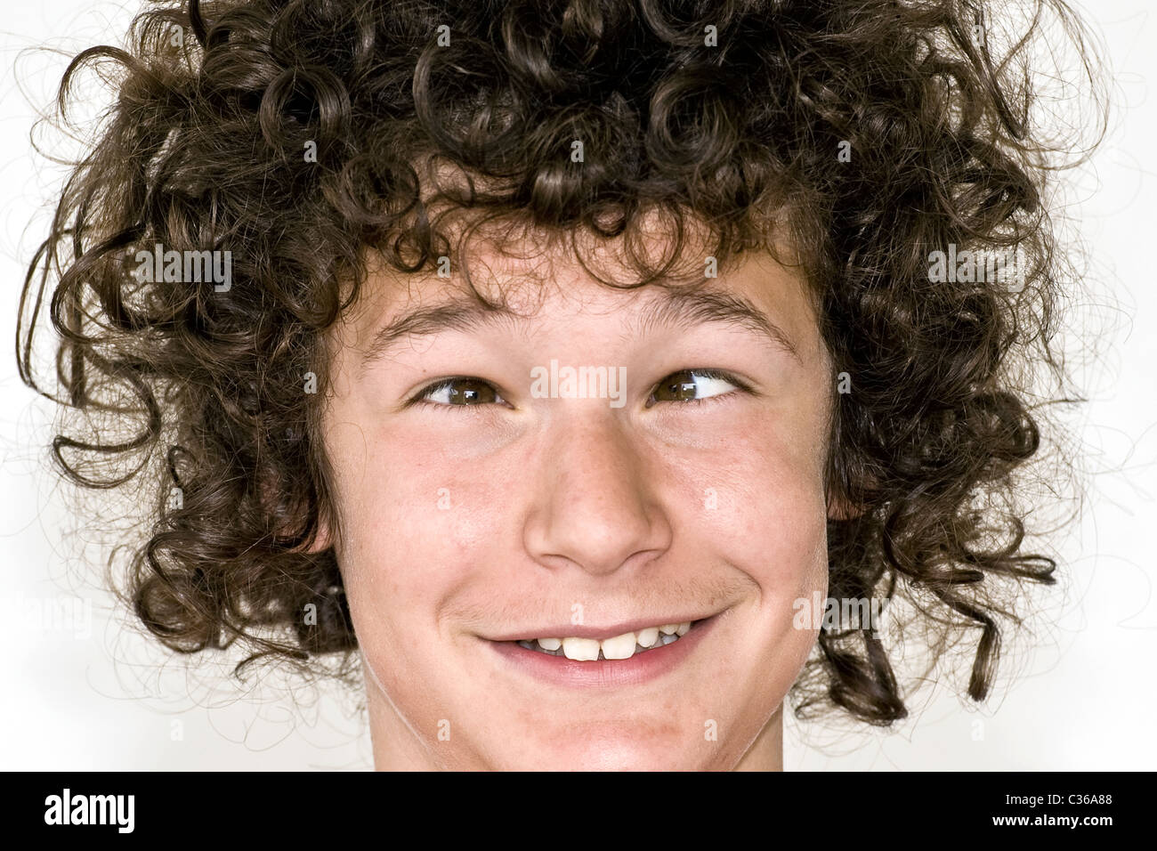 Strabism hi-res stock photography and images - Alamy