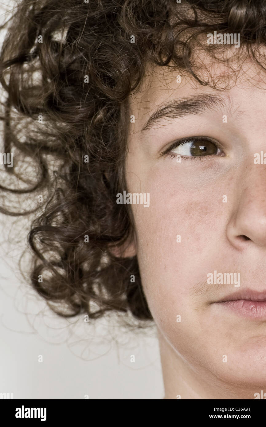 Strabismus boy hi-res stock photography and images - Alamy