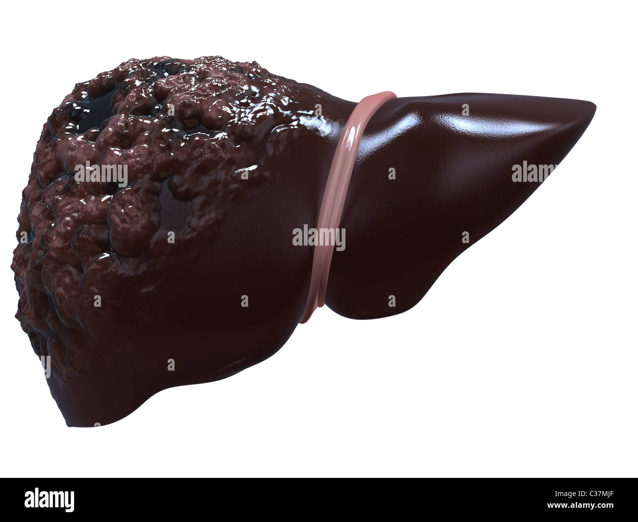 Male cancer Cut Out Stock Images & Pictures - Alamy